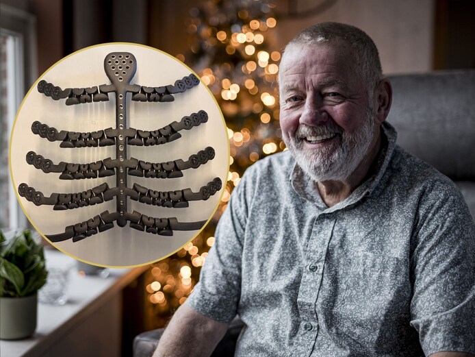 Hoe eenvoudige dotterbehandeling dramatisch afloopt en leidt tot het ...