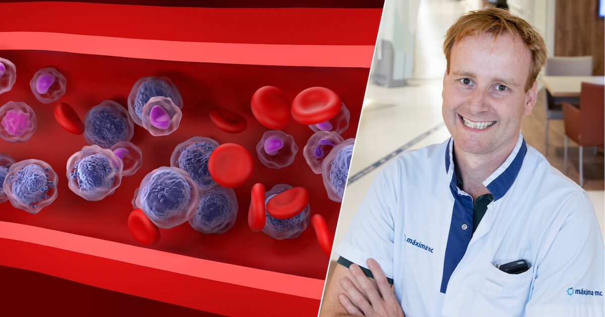 Zo’n 900 Nederlanders krijgen jaarlijks diagnose acute leukemie: dit ...