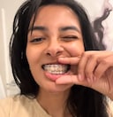 ‘Jawbreaker’-snoep doet naam eer aan: Canadese Javeria (19) breekt kaak ...