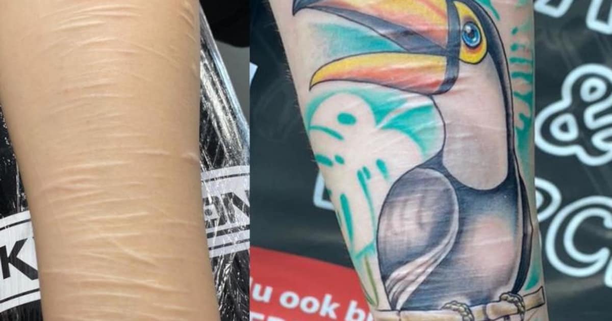 Littekens omgetoverd tot prachtige tattoo & 2 nieuwe Indiase ...