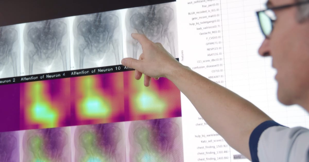 De beste specialist beoordeelt voortaan röntgenfoto’s en scans in ...
